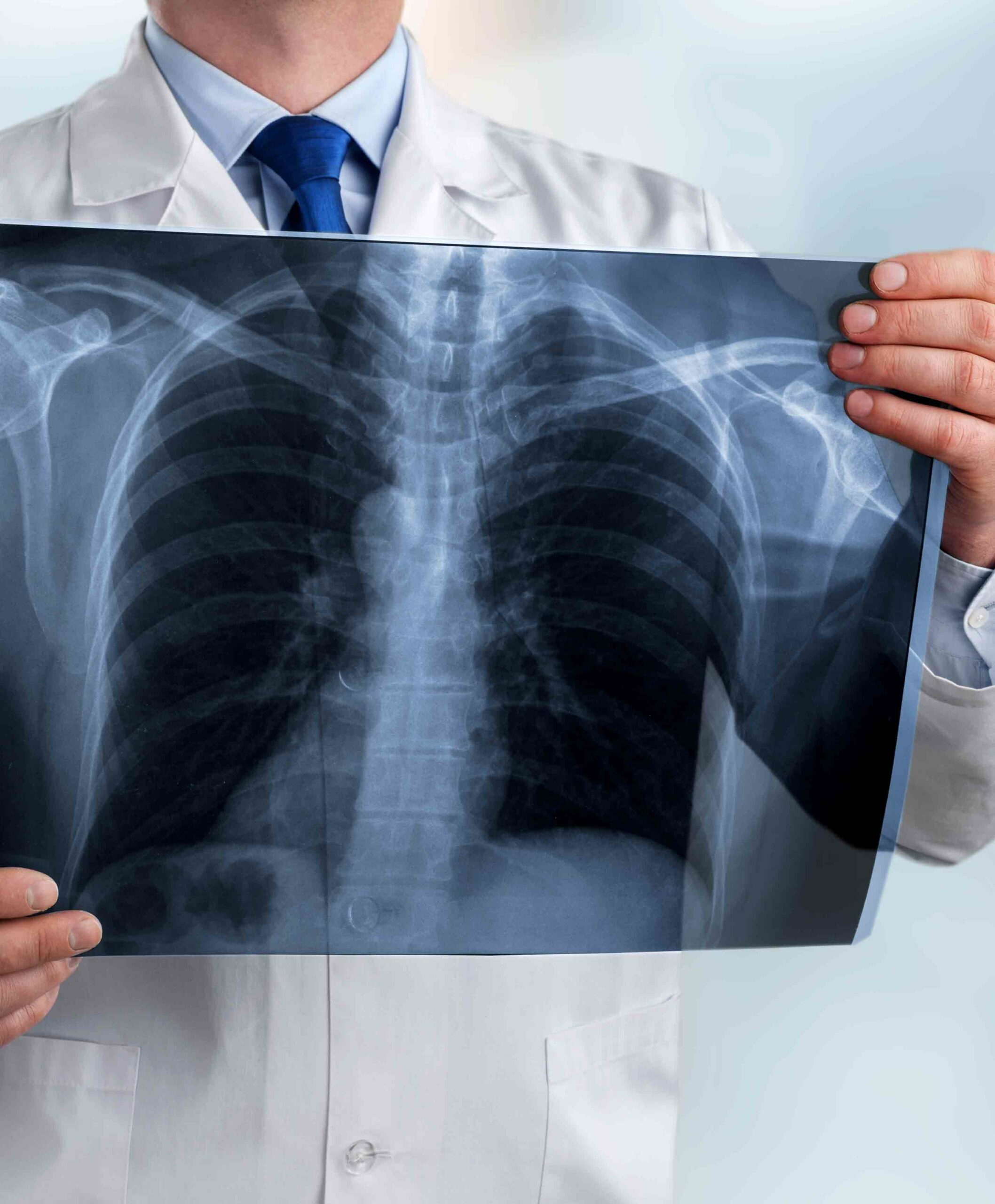 Experto en Rayos X | Esneca Medical Latinoamérica