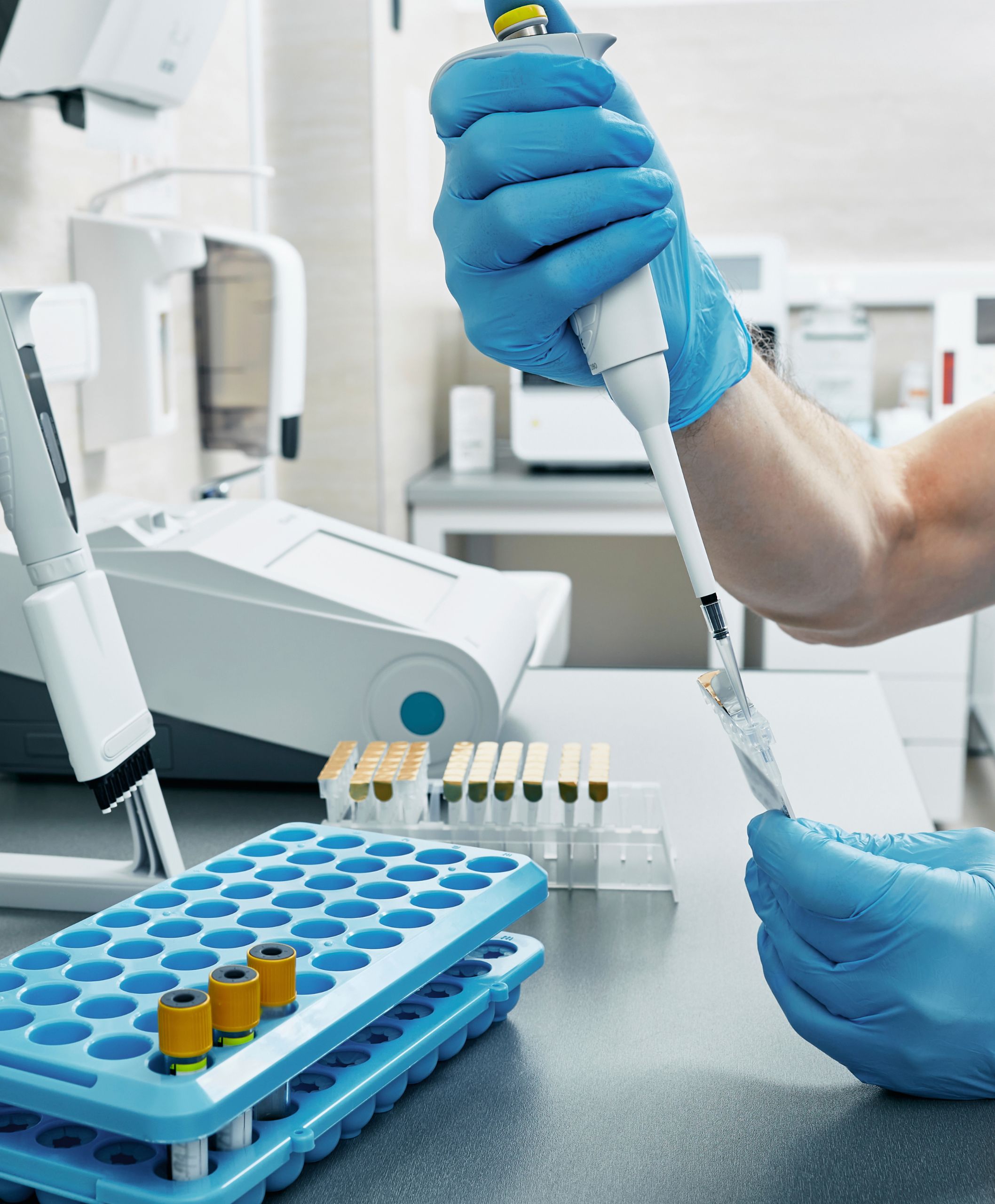 Maestría Internacional en Hemostasia y Anticoagulación Clínica | Esneca ...